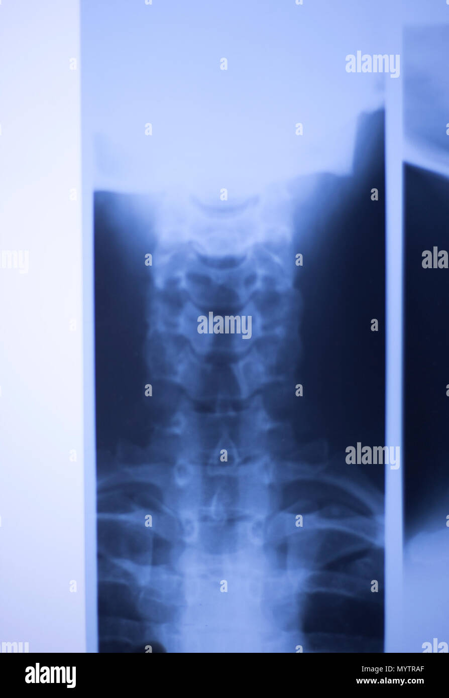 Medical hospital x-ray lowe back pain spine and neck traumatology scan ...