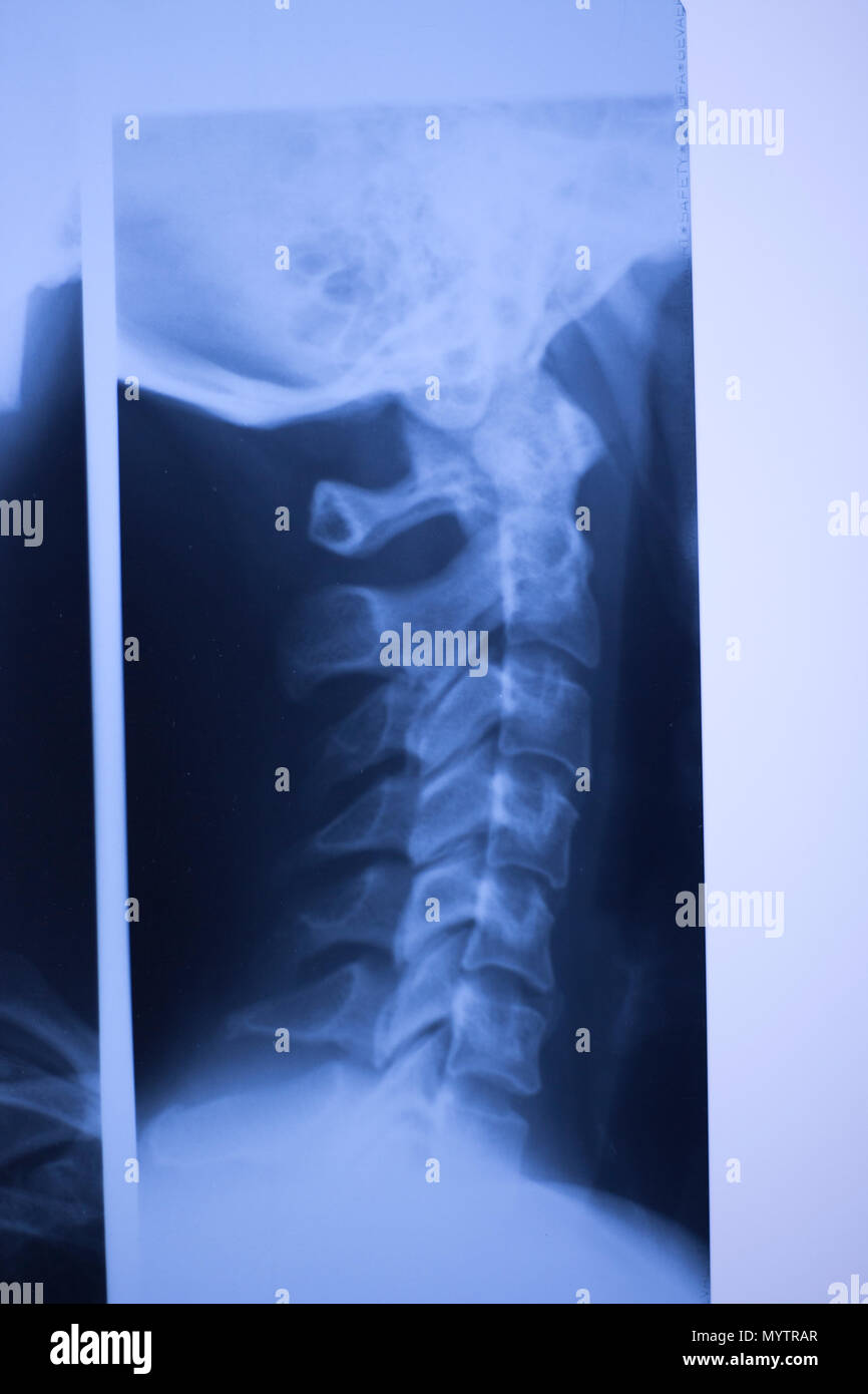 Medical hospital x-ray lowe back pain spine and neck traumatology scan ...