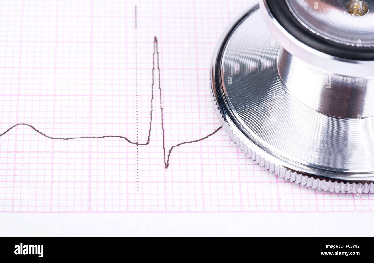 Medical stethoscope to listen to the heart on the cardiogram closeup ...