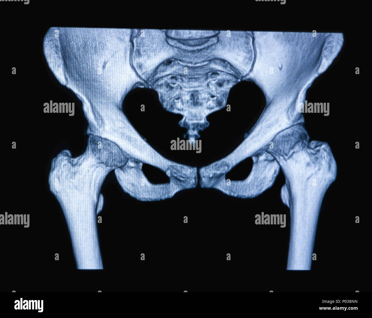 Hip Scan High Resolution Stock Photography and Images - Alamy