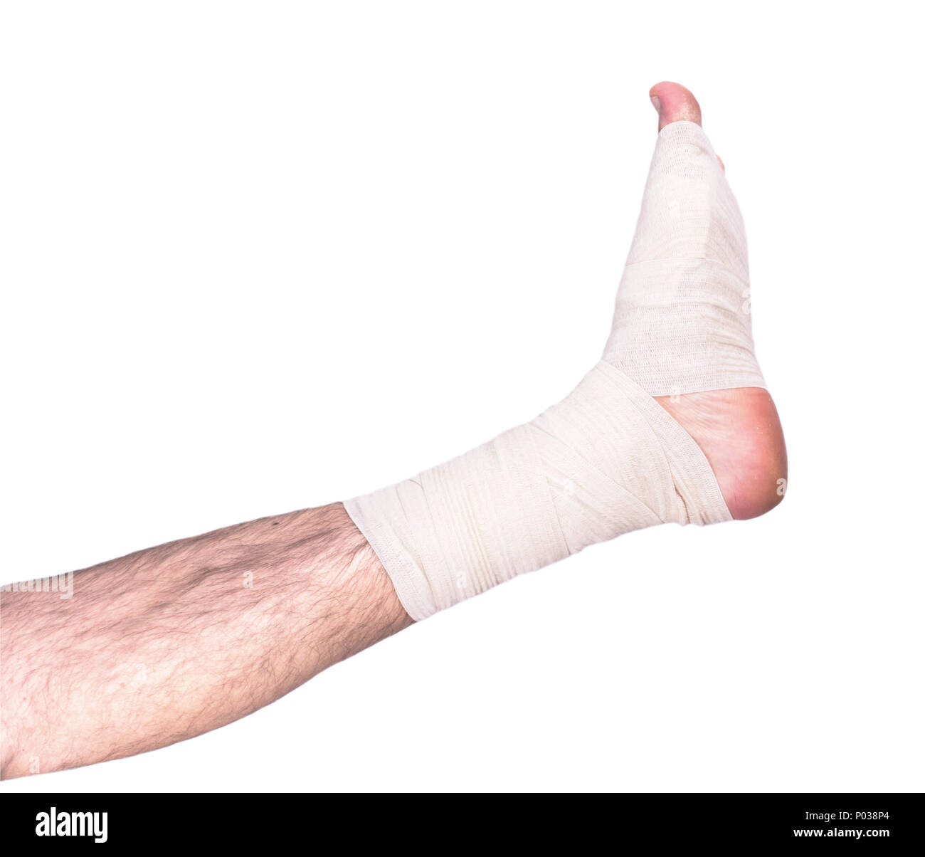 Bandaged foot hi-res stock photography and images - Alamy