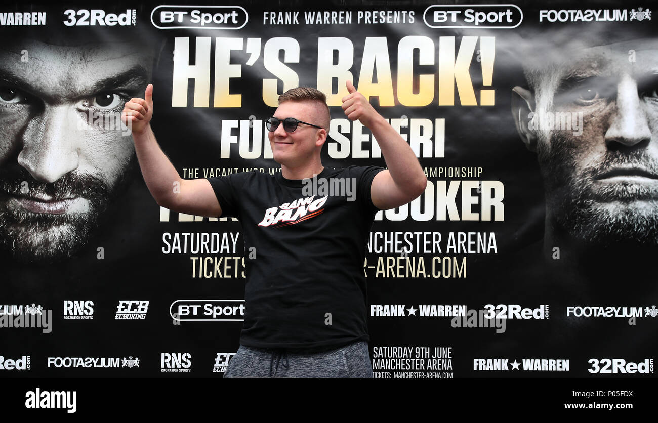 Former boxer Nick Blackwell during the weigh-in at The Great Northern ...