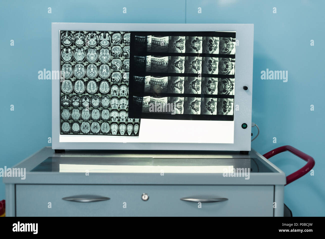 medical screen with x-ray in modern hospital Stock Photo - Alamy