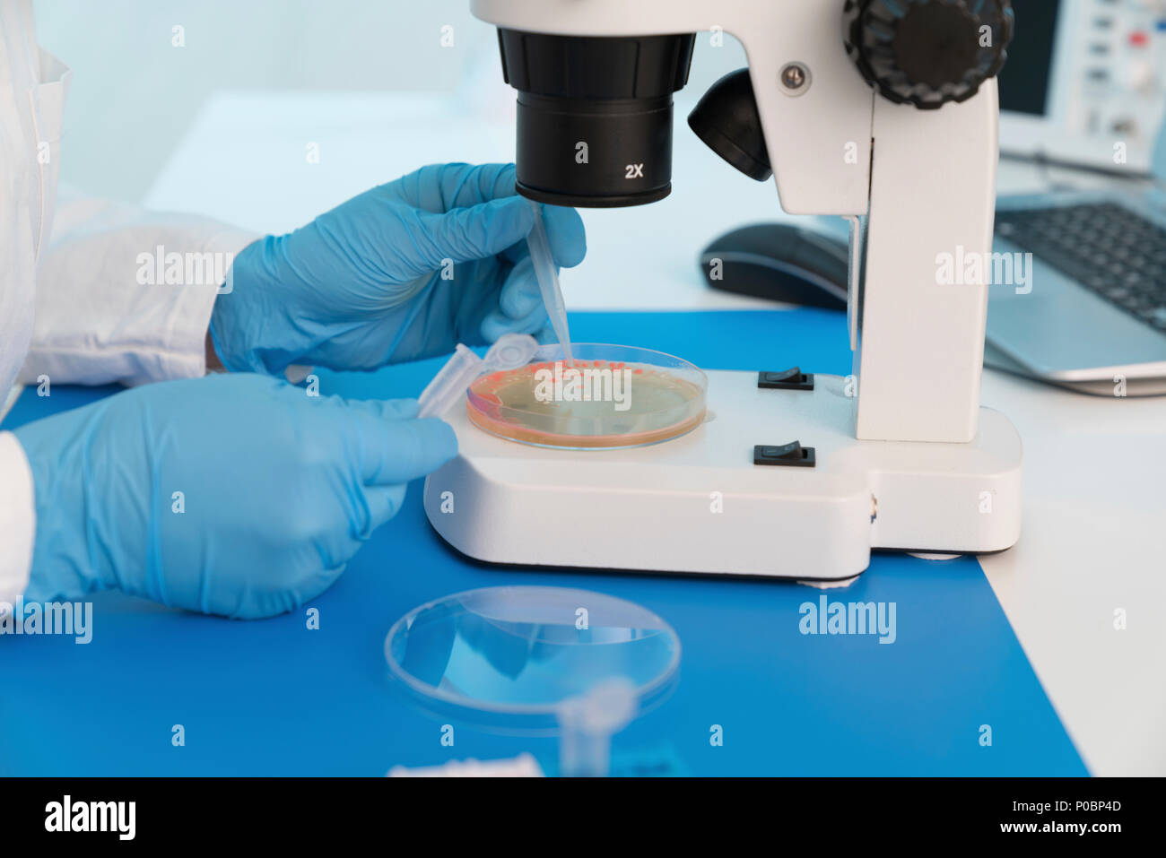 What Is A Stock Culture In Microbiology at James Mcnaughton blog