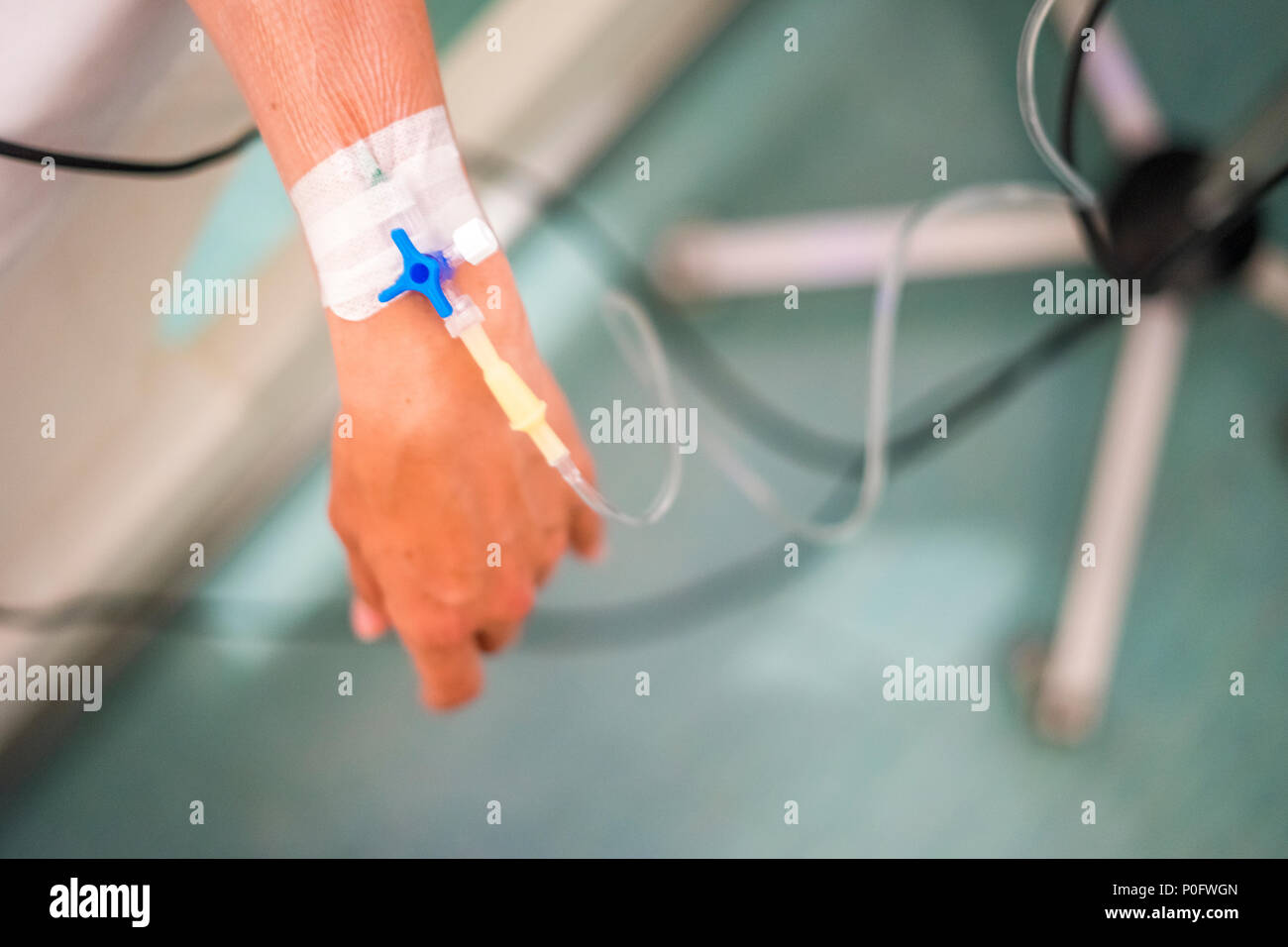 Peripheral venous catheter on the hand of young Caucasian woman Stock ...