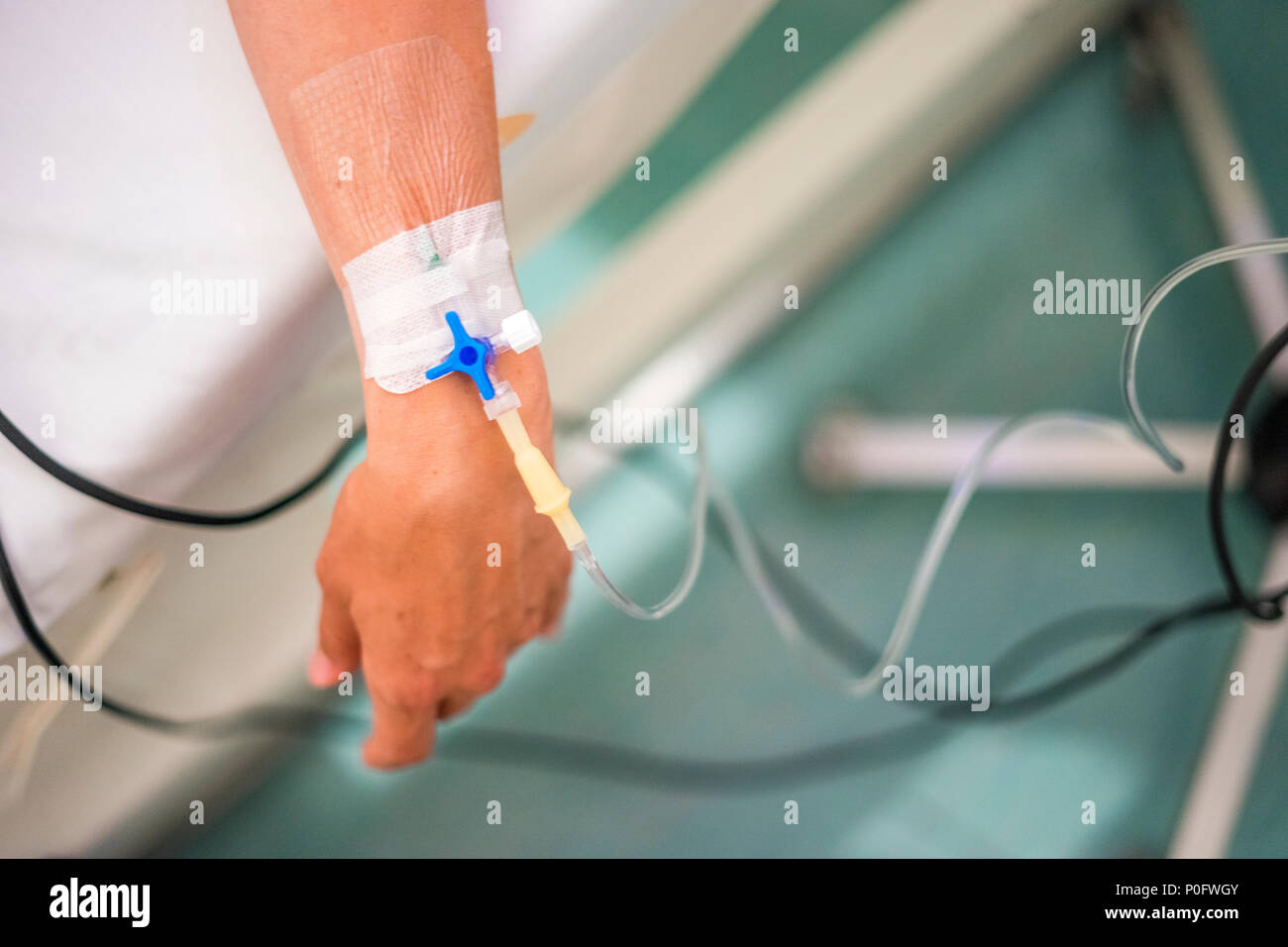 Peripheral venous catheter on the hand of young Caucasian woman Stock ...