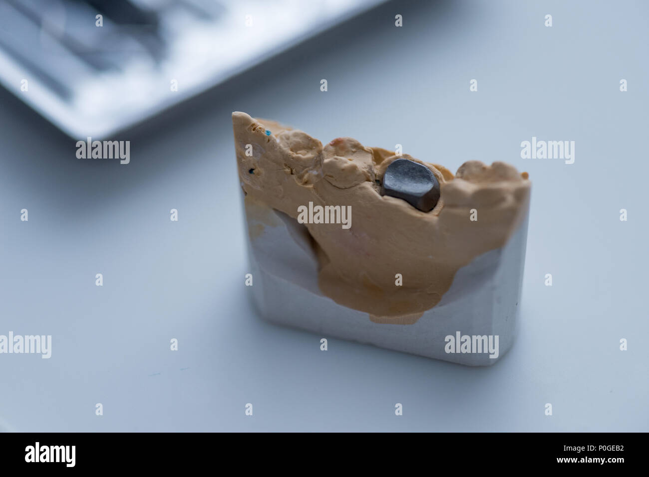 close up view of dental mold on table in dentist office Stock Photo - Alamy