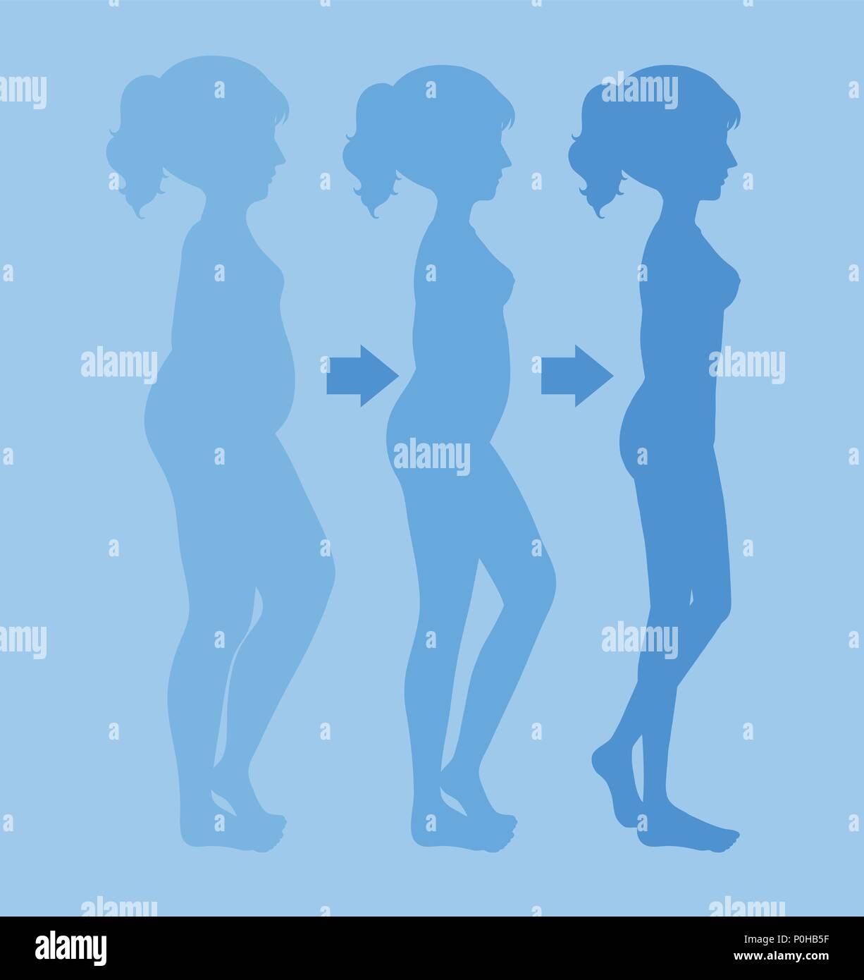 A Young Woman Losing Weight illustration Stock Vector Image & Art - Alamy