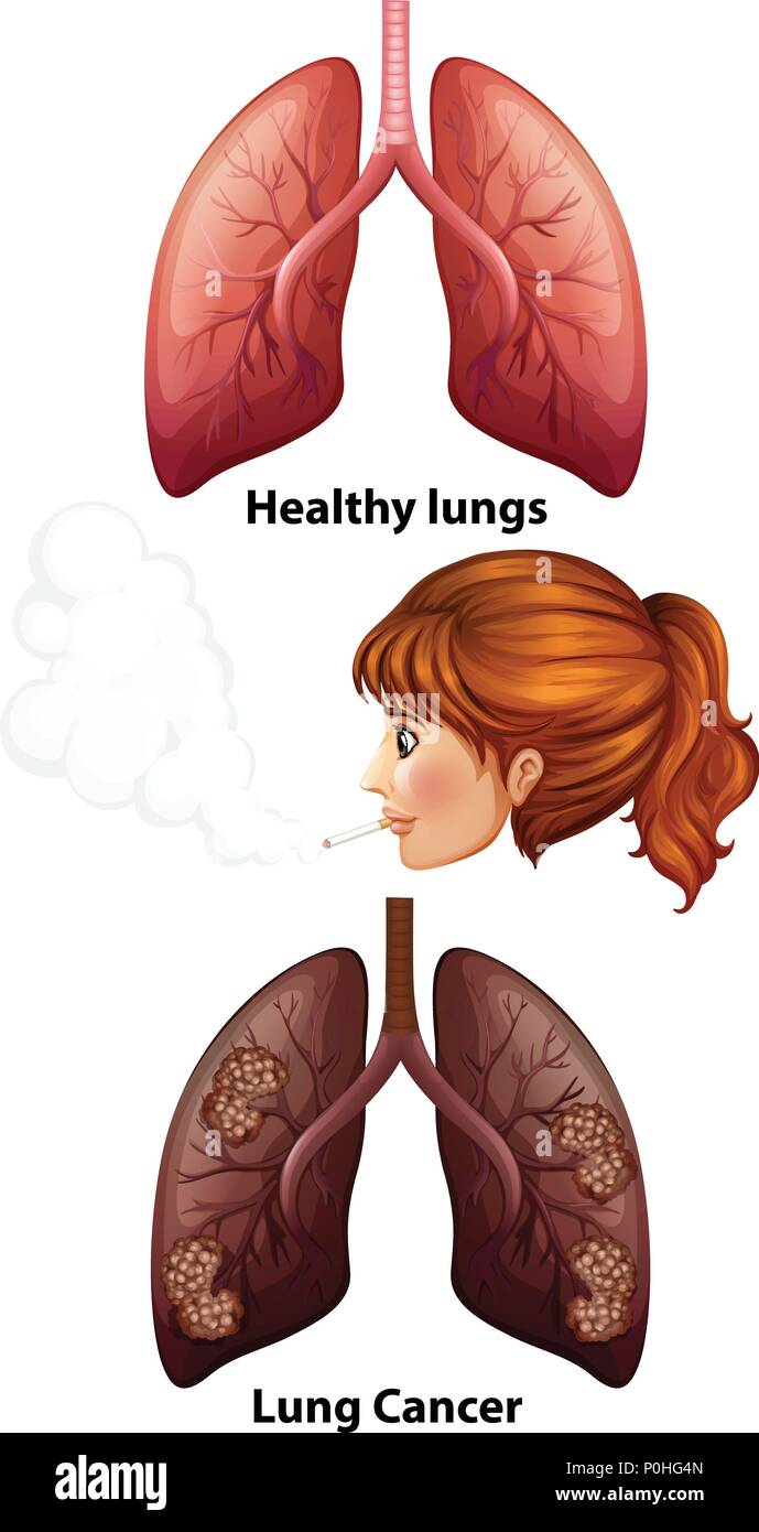 Smoking women Stock Vector Images - Alamy