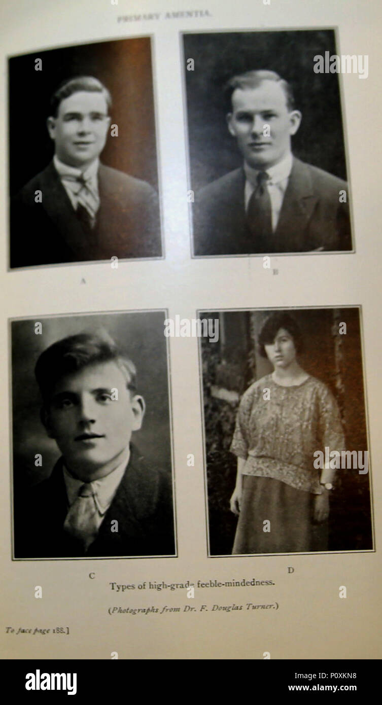 Mental deficiency hi-res stock photography and images - Alamy