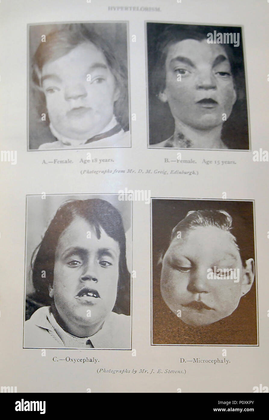 'MENTAL DEFICIENCY' (Amentia), FIFTH EDITION, 1929... IMG 3569 edited ...
