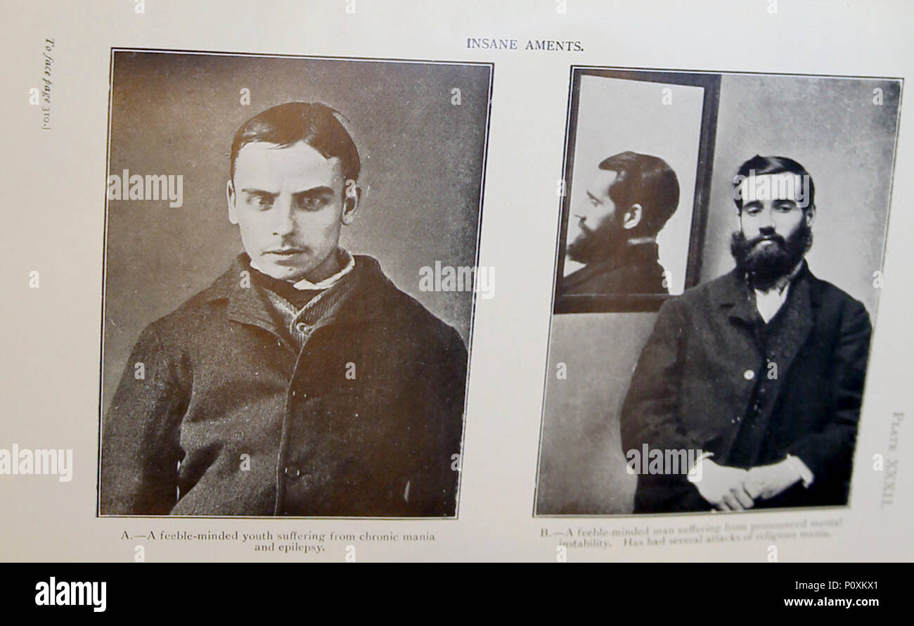 'MENTAL DEFICIENCY' (Amentia), FIFTH EDITION, 1929... IMG 3569 edited ...