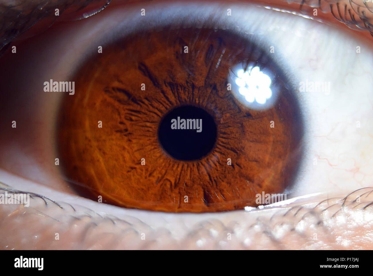 Constricted pupil eye hi-res stock photography and images - Alamy