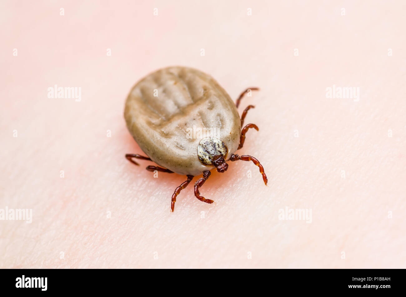 Encephalitis Virus or Lyme Disease or Monkey Fever Infected Tick ...