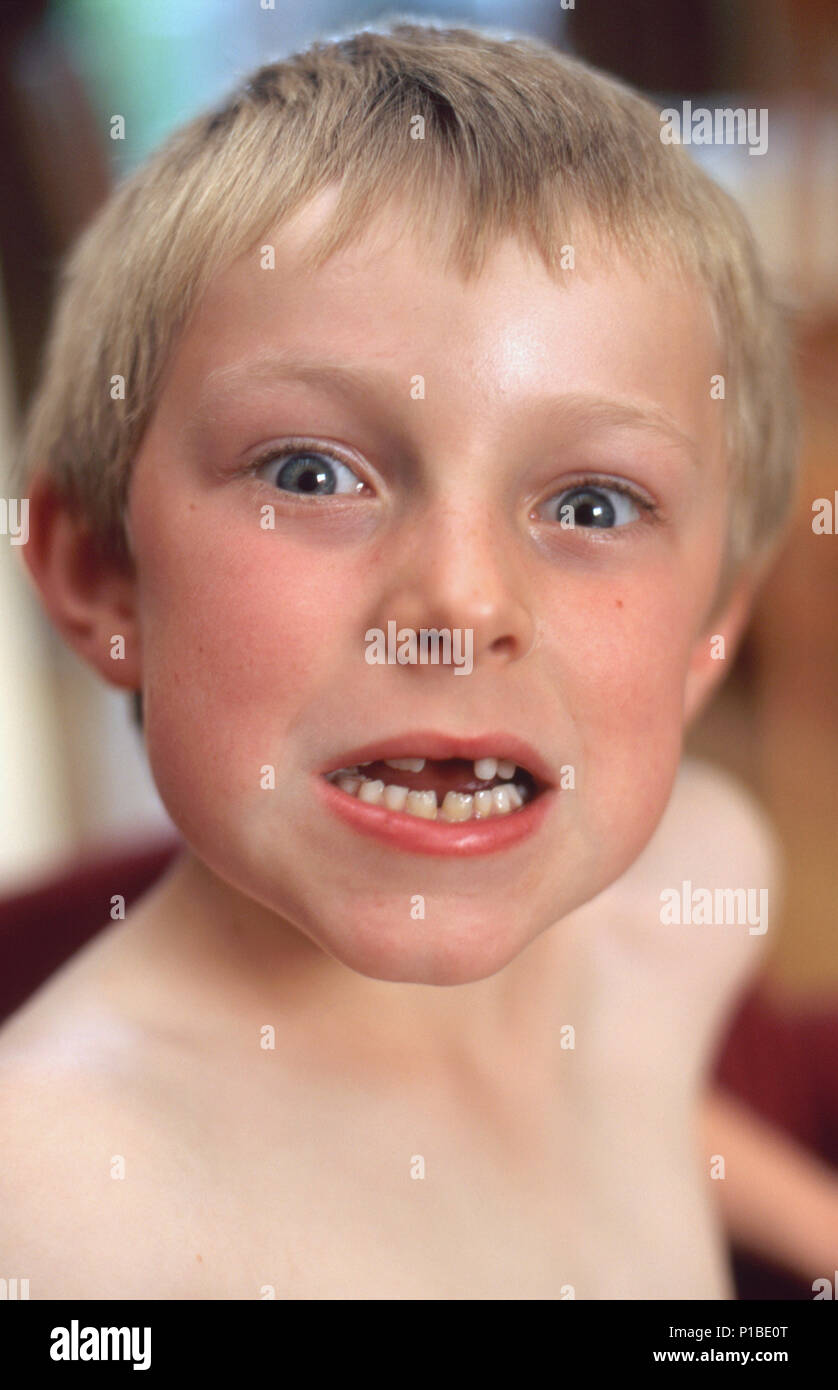 Child teeth gap hi-res stock photography and images - Alamy