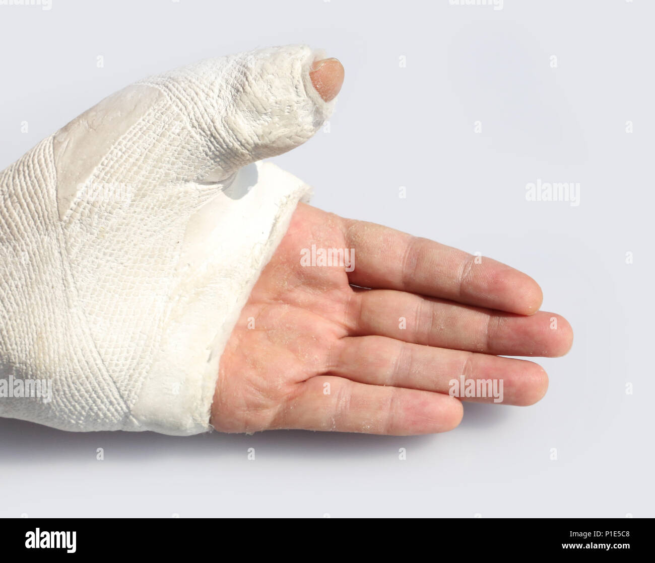 Immobilize hi-res stock photography and images - Alamy