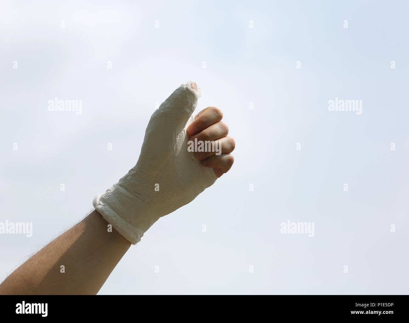 Hand of the injured person who raises the thumb completely blindfolded ...