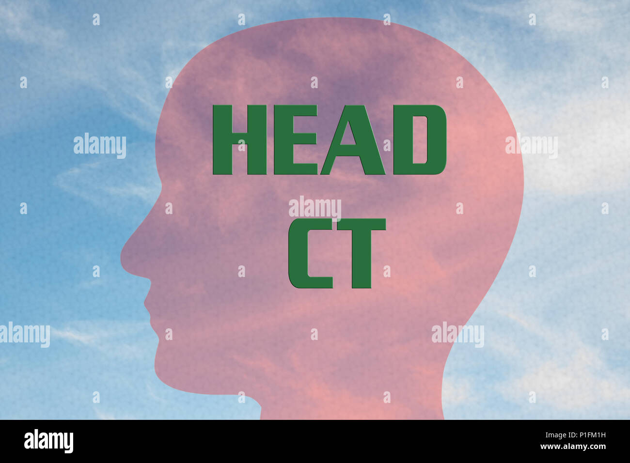 Render illustration of HEAD CT title on head silhouette, with cloudy ...