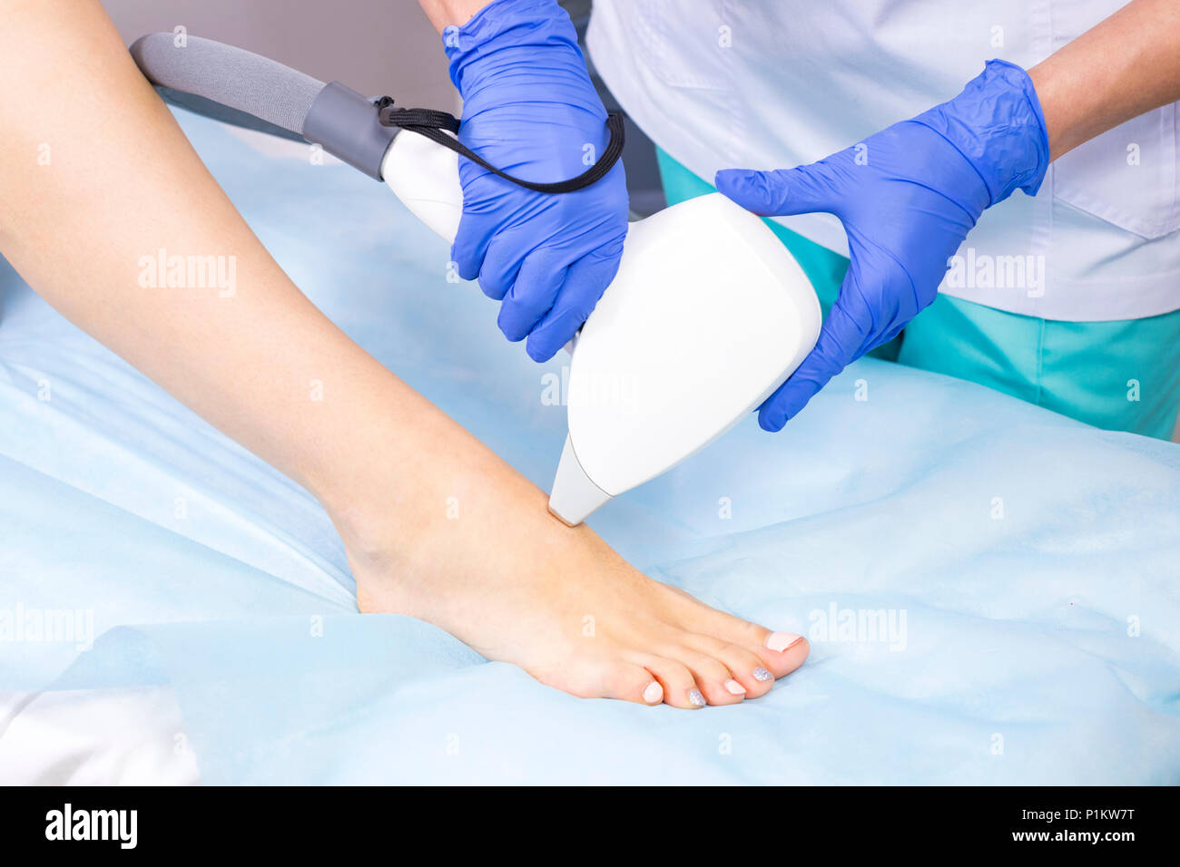 The process of laser depilation of female limbs in the beauty salon ...