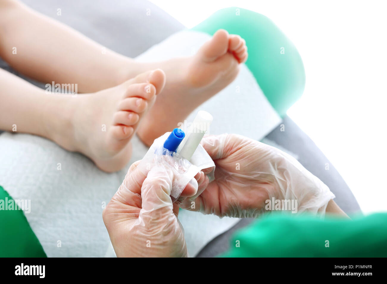 Diagnostics, taking material for mycological examination Stock Photo ...