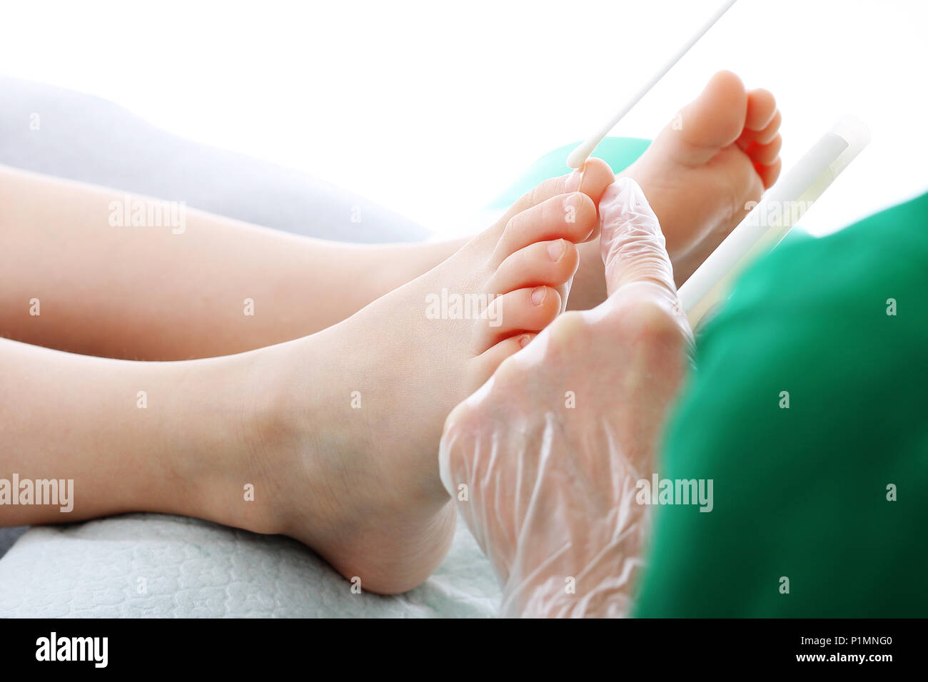 Diagnostics, taking material for mycological examination Stock Photo ...