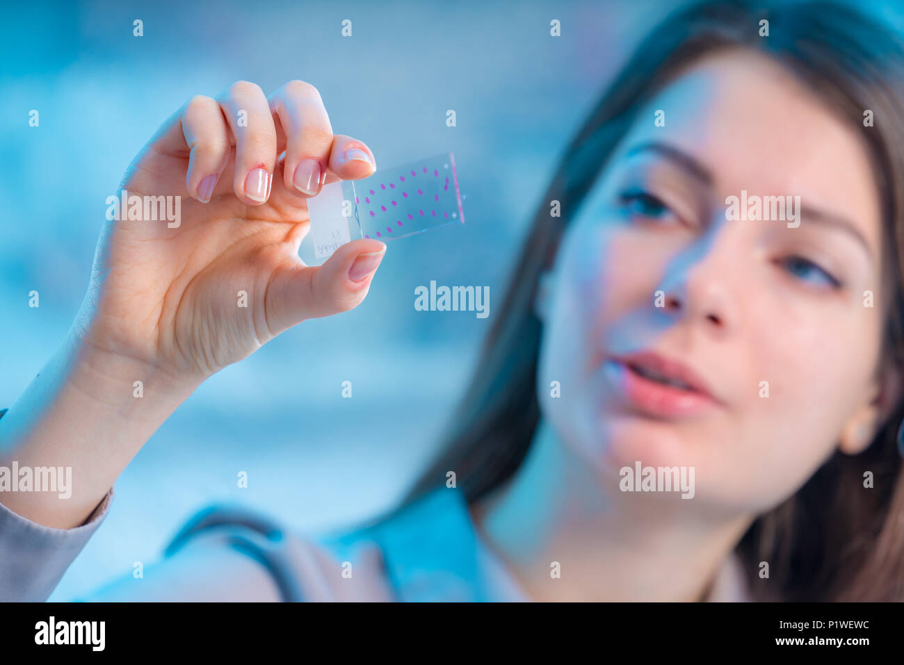 Blood sample on microscope slide. Researcher Analyzing Microscope Slide ...
