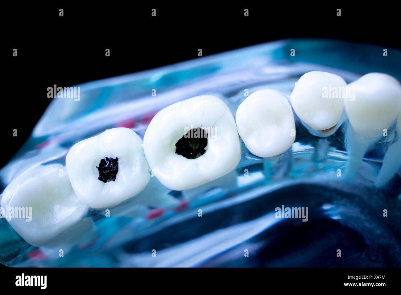 Dentist dental teeth teaching model showing each tooth and gum for ...