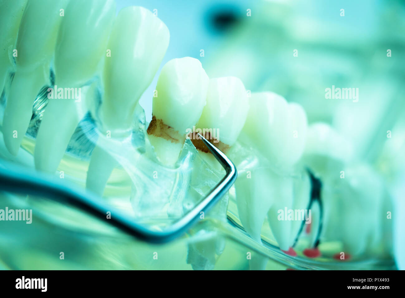 Dentist cleaning teeth with titanium metal tooth pick instrument to ...