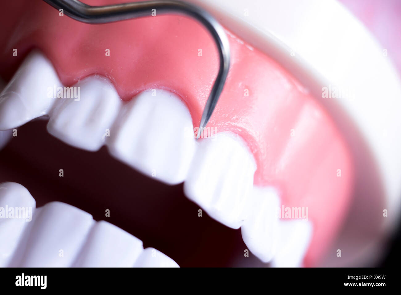 Dentist cleaning teeth with titanium metal tooth pick instrument to ...