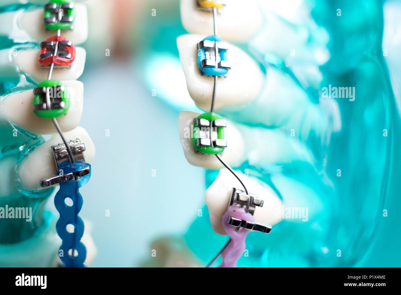 Dental metal braces teeth retainer aligners teaching orthodontics model ...