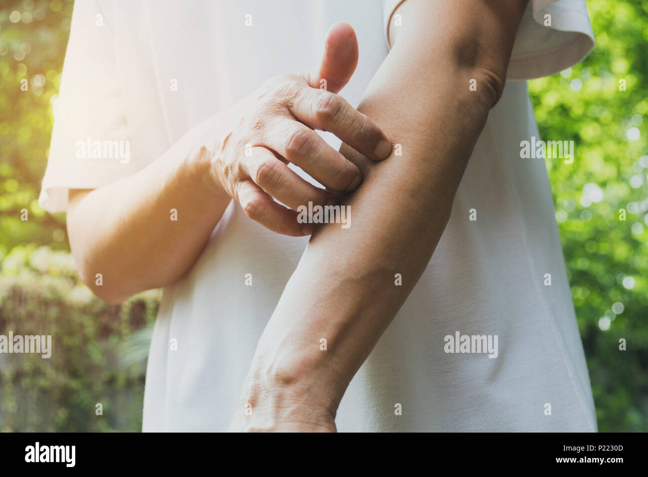 Boy scratching arm hi-res stock photography and images - Alamy