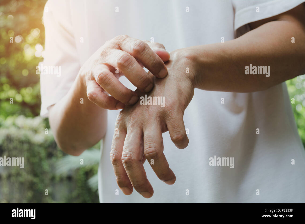 Young woman scratching her arm hi-res stock photography and images - Alamy