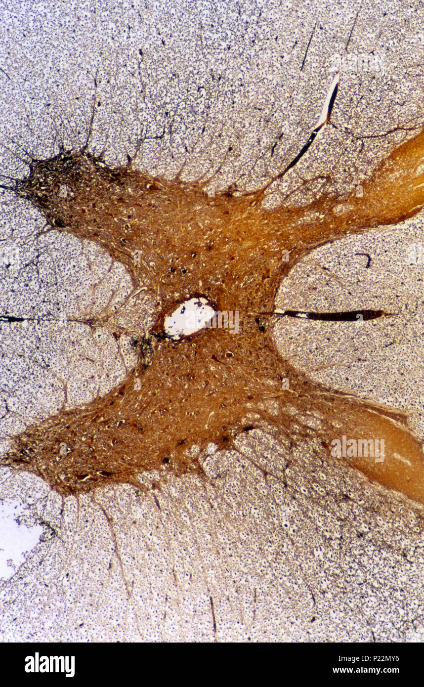 Multipolar neuron of the spinal cordon. Nervous tissue 14x Stock Photo ...