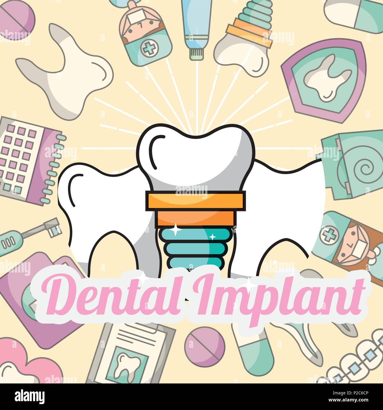 Dental tooth implant titanium Stock Vector Images - Alamy