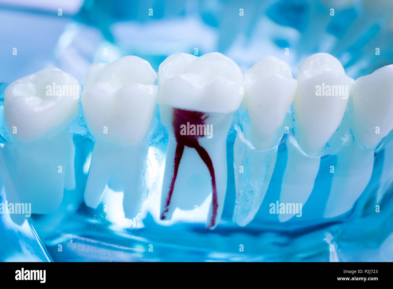Dentist dental teeth teaching model showing each tooth and gum for ...
