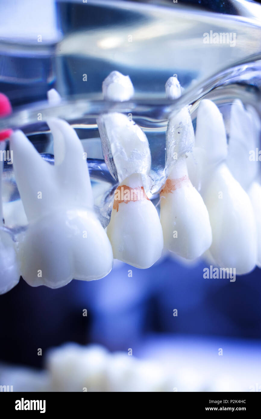 Dentist dental teeth teaching model showing each tooth and gum for ...