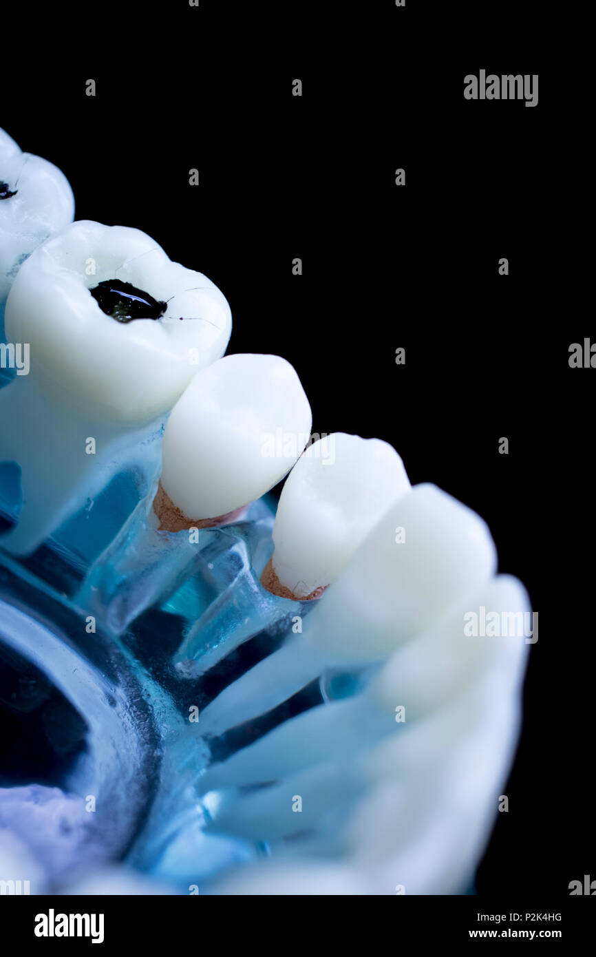 Dentist dental teeth teaching model showing each tooth and gum for ...