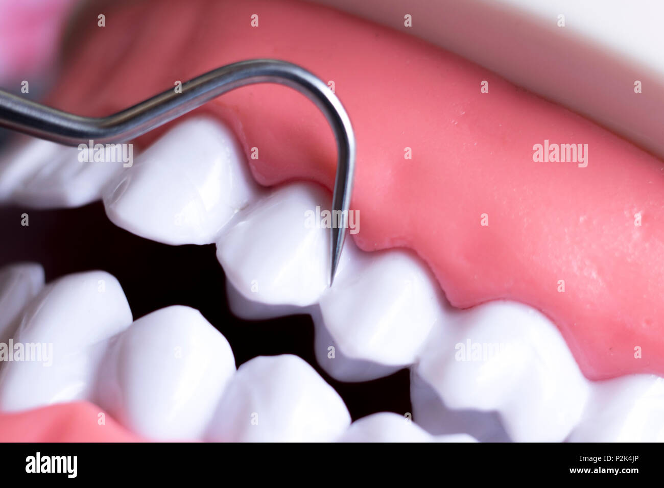 Dentist cleaning teeth with titanium metal tooth pick instrument to ...