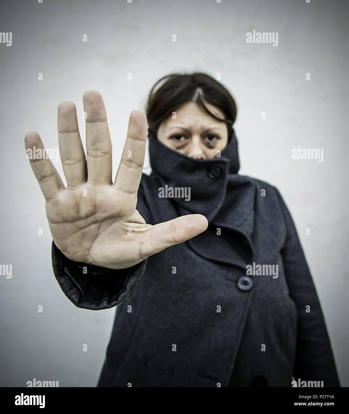 Battered woman battered woman black eye hi-res stock photography and ...