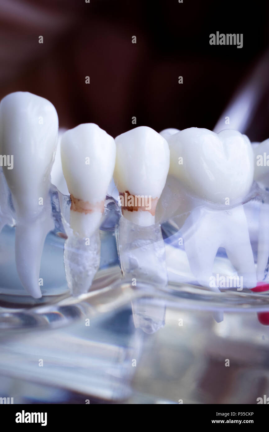 Dentist dental teeth teaching model showing each tooth and gum for ...