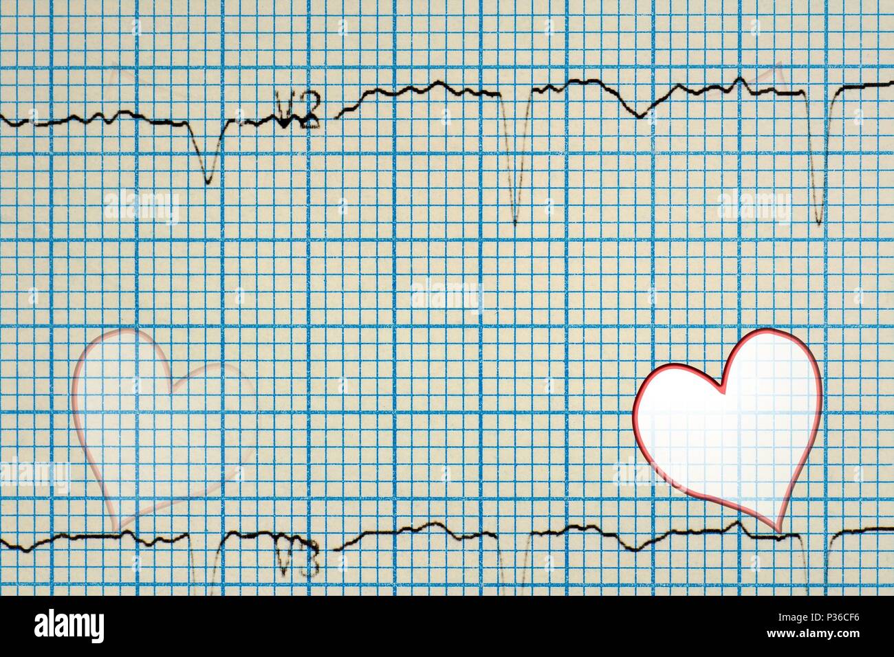 Heart analysis, electrocardiogram graph (ECG Stock Photo - Alamy