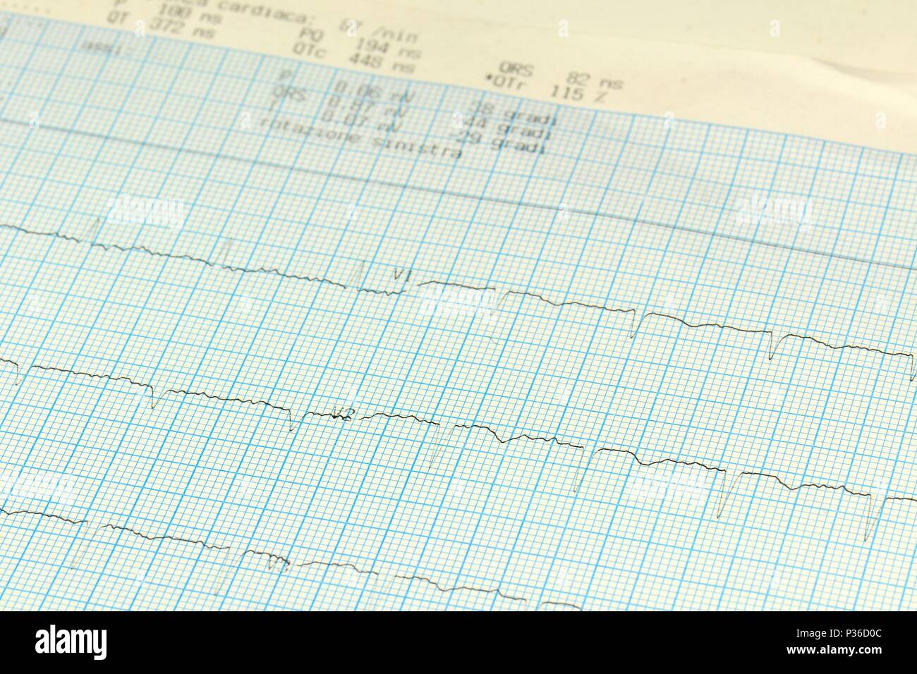 Heart analysis, electrocardiogram graph (ECG). Selective focus Stock ...