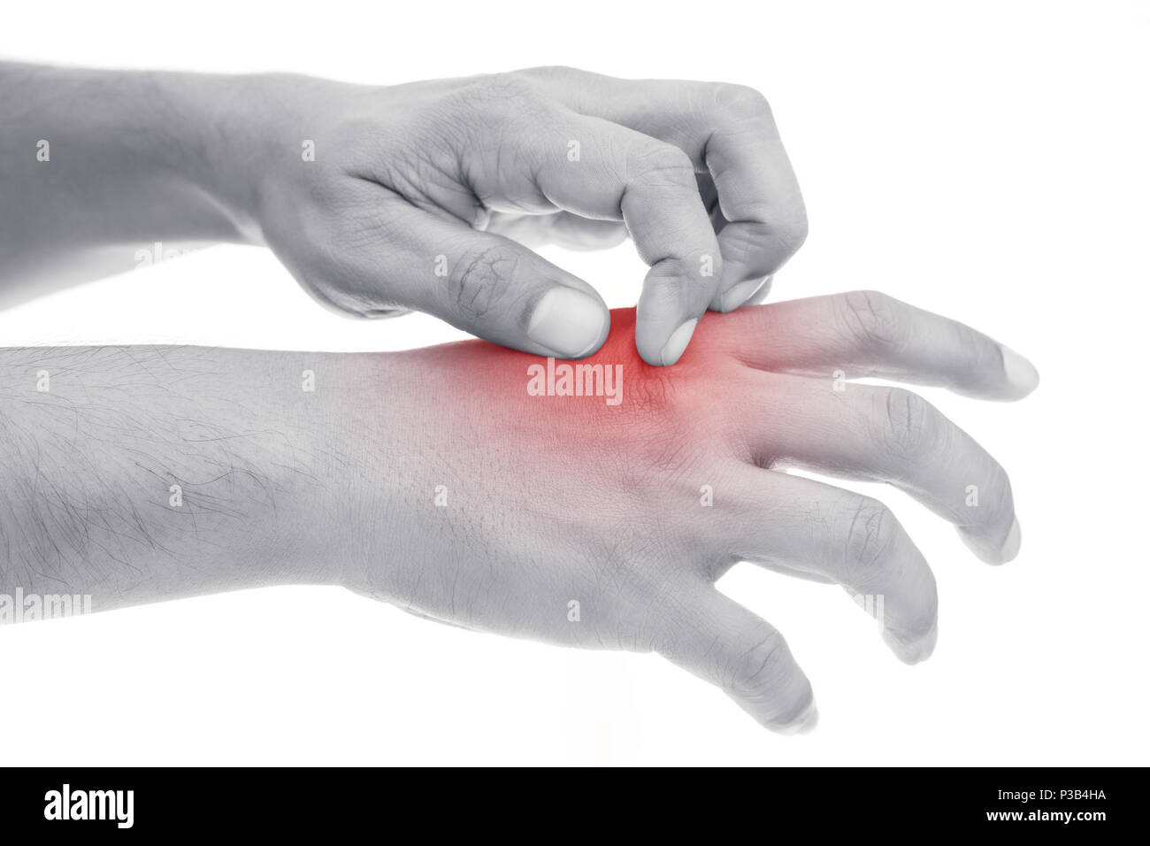 People scratch the itch with hand. itching, Concept with Healthcare And ...