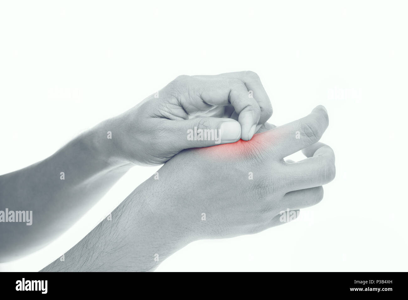 Man scratch the itch with hand. itching, Arm, Concept with Healthcare ...