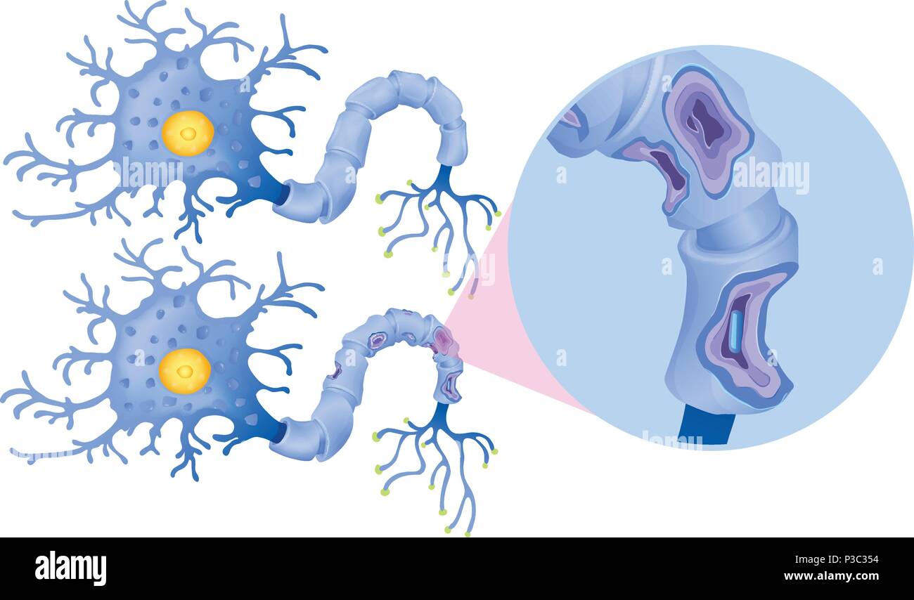 Nerve cell vector vectors hi-res stock photography and images - Alamy