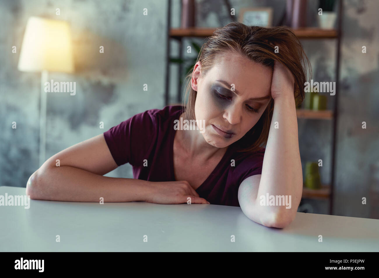 Young wife with blue eye suffering from home abuse Stock Photo - Alamy