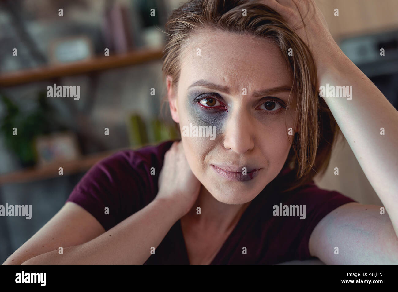 Split lip hi-res stock photography and images - Alamy