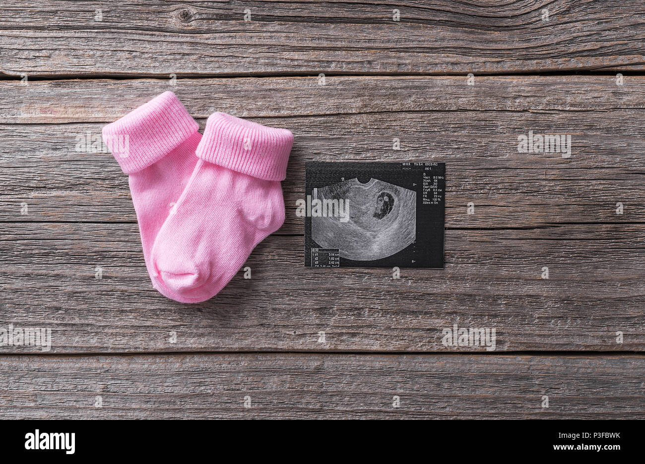 Ultrasound scan picture hi-res stock photography and images - Alamy