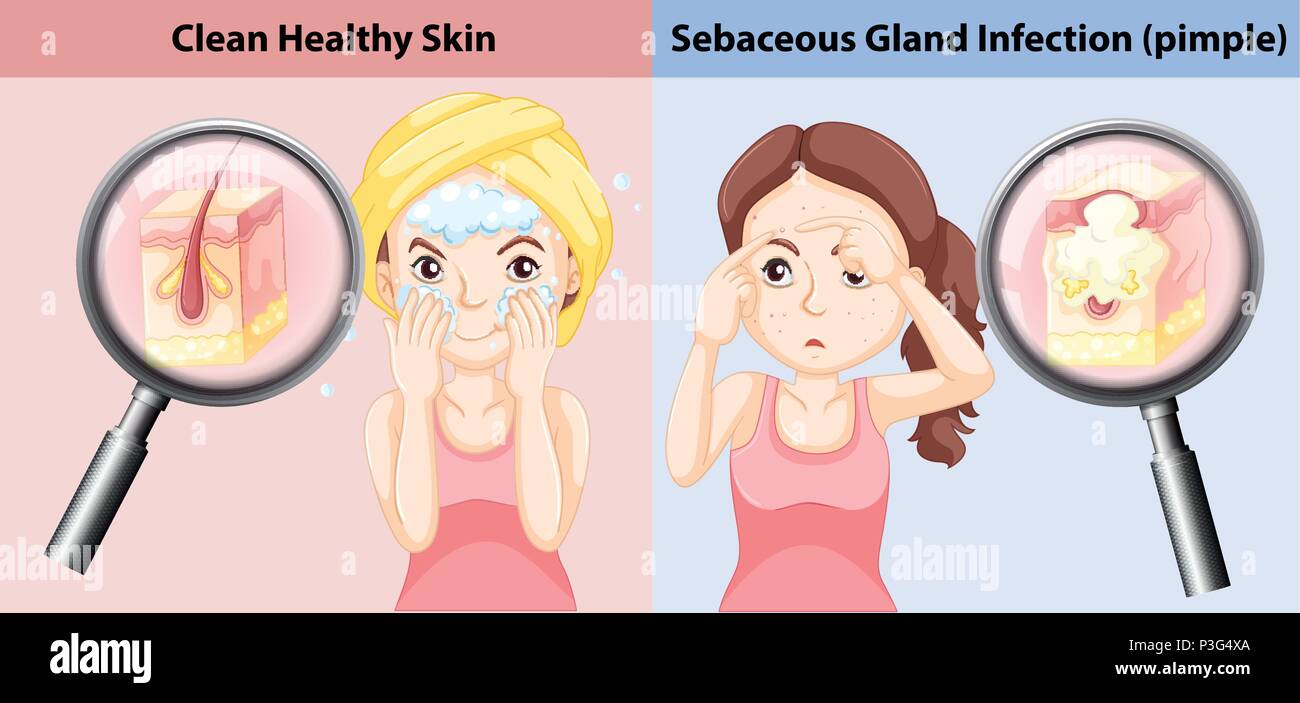 A Comparison of Skin Condition illustration Stock Vector Image & Art ...