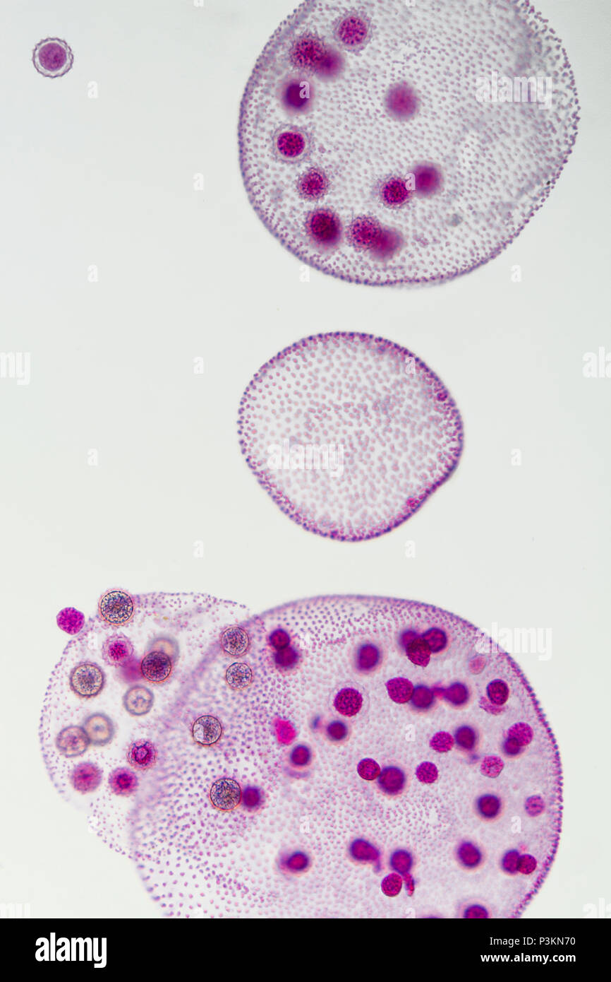 Volvox a polyphyletic genus of chlorophyte green algae Stock Photo - Alamy Volvox a polyphyletic genus of chlorophyte green algae Stock Photo - Alamy